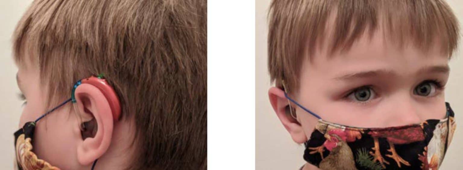 How to Wear a Mask With Hearing Aids - Dr. Rosner ENT Specialist